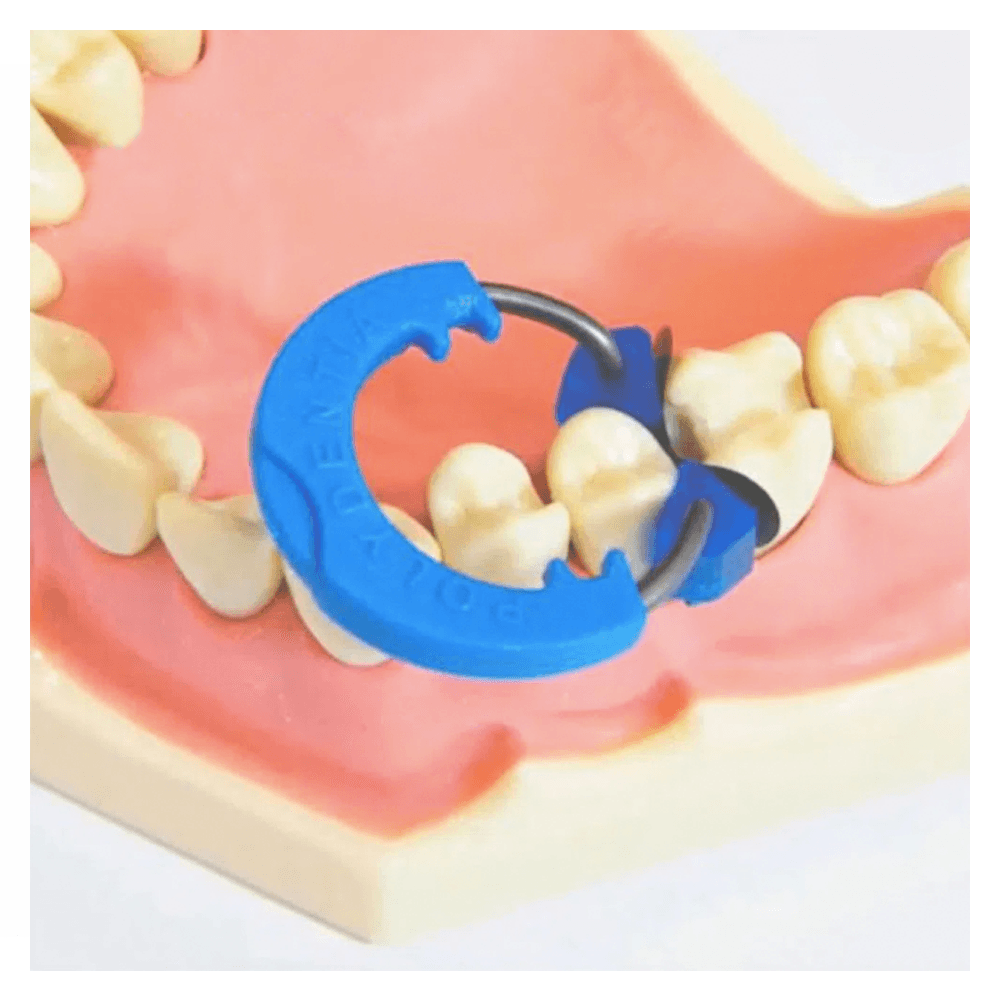 Kit Starter my Quickmat Clássico - Polydentia - dentalecia