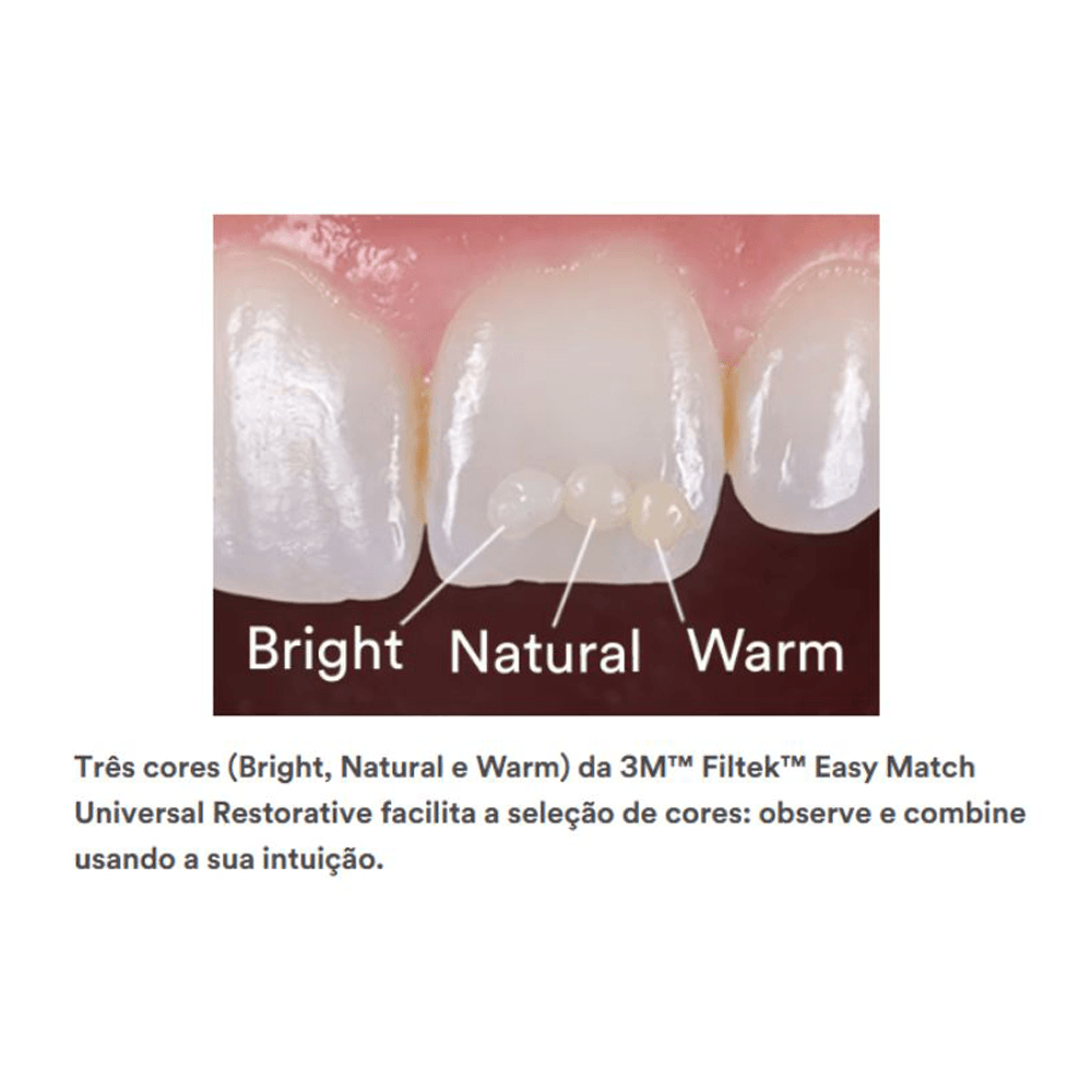 Resina Filtek Easy Match - Solventum - dentalecia