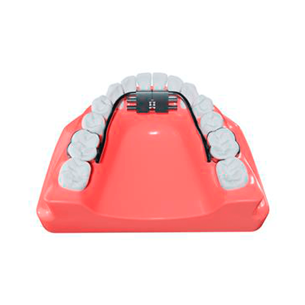 Expansor Mini Hyrax - Morelli - dentalecia