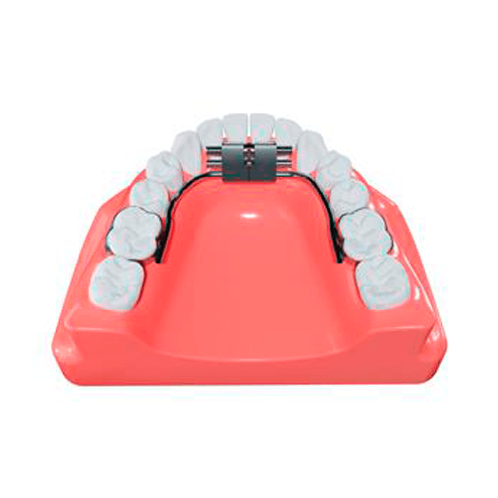 Expansor Mini Hyrax - Morelli - dentalecia